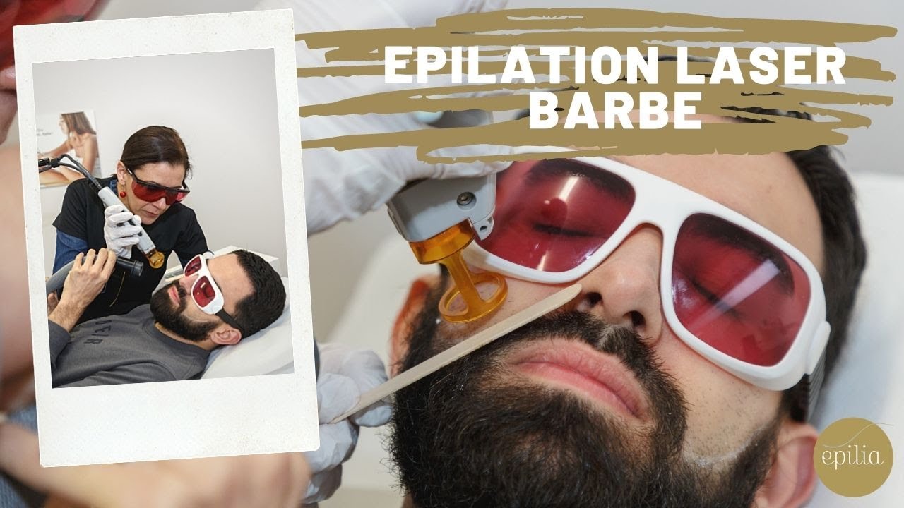 Epilation du contour de barbe - Epilia, le spécialiste de l'épilation ...