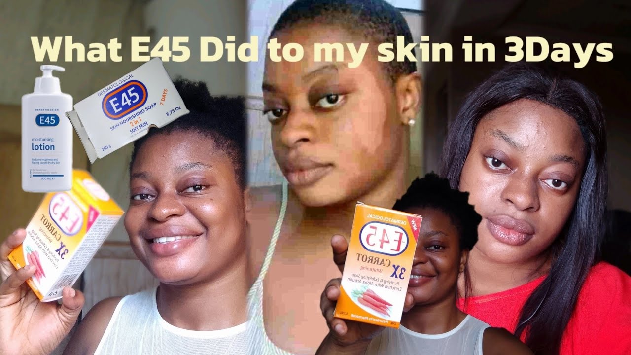 DONT USE E45?, Skincare Product for sensitive skin, Treatments for skin ...