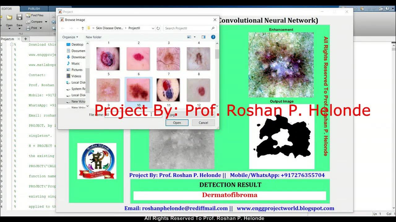 Skin Disease Detection Using Matlab | Skin Disease Detection Using ...