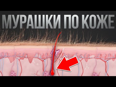 ПРОБЕЖАЛИСЬ МУРАШКИ ПО КОЖЕ? - ОБЬЯСНЯЕМ ПОЧЕМУ