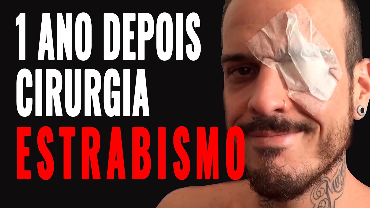 SOBRE SER VESGO | 1 ANO DEPOIS DE OPERAR O ESTRABISMO! por HENRIQUE ...