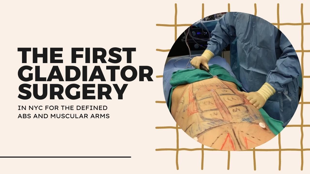 THE FIRST GLADIATOR SURGERY IN NYC FOR THE DEFINED ABS AND MUSCULAR ...