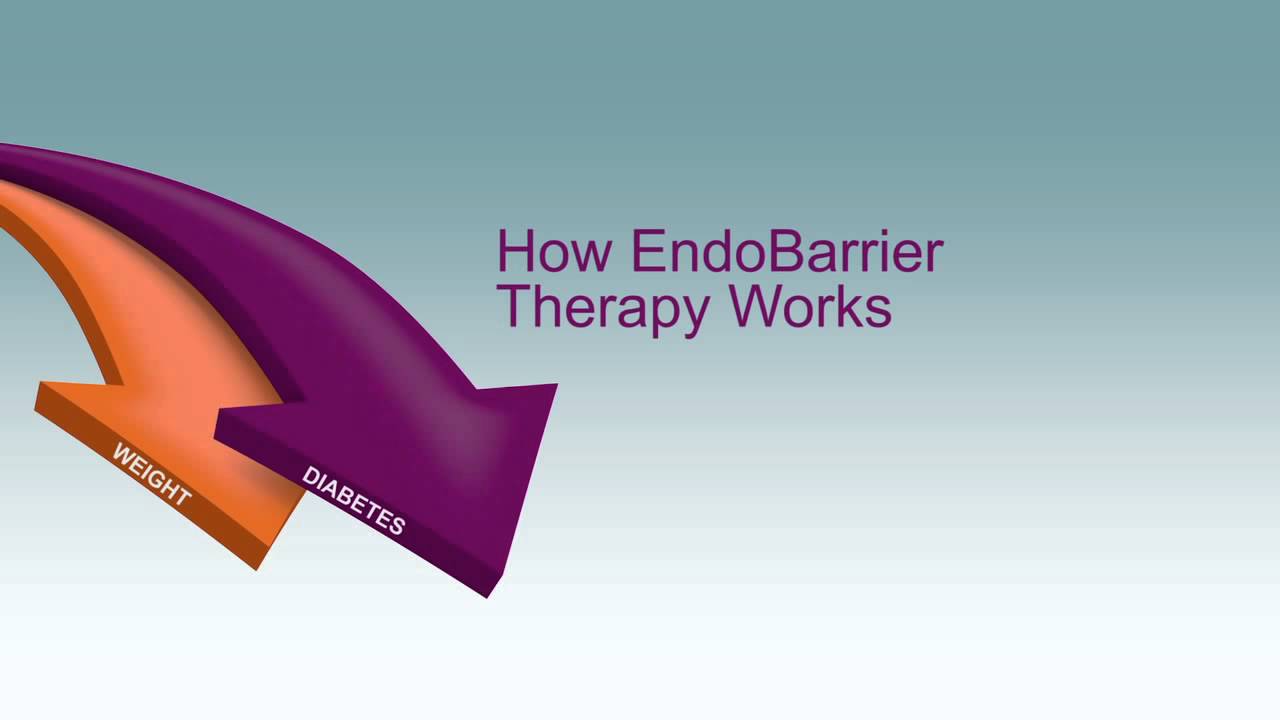 EndoBarrier - YouTube