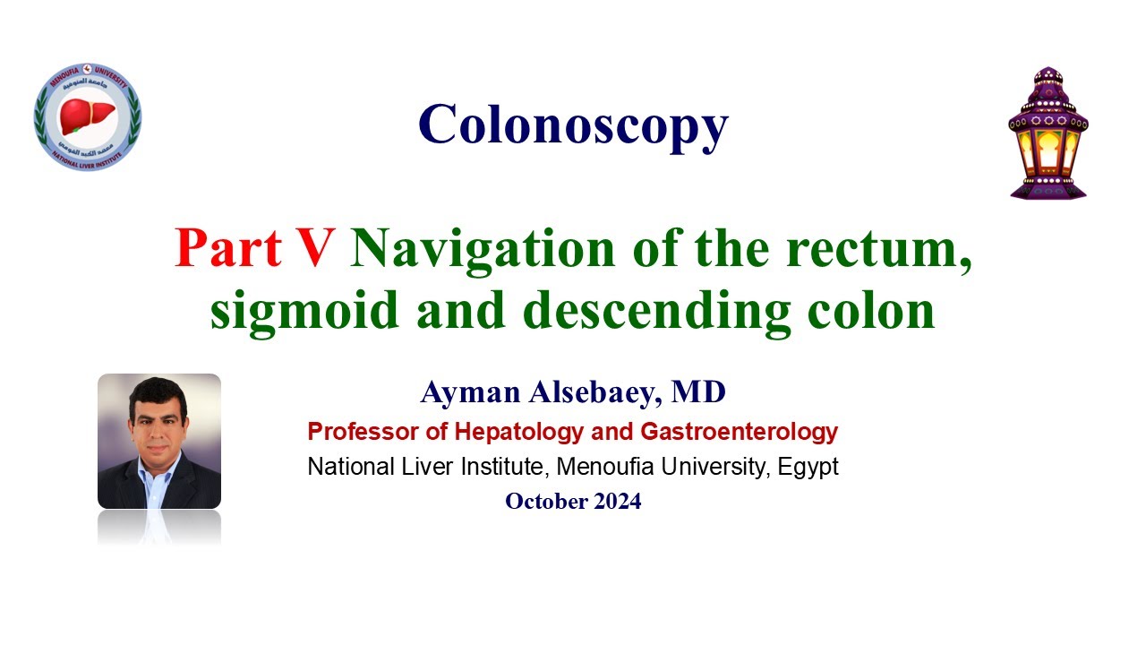 Colonoscopy Part V Navigation of the rectum, sigmoid, and descending ...