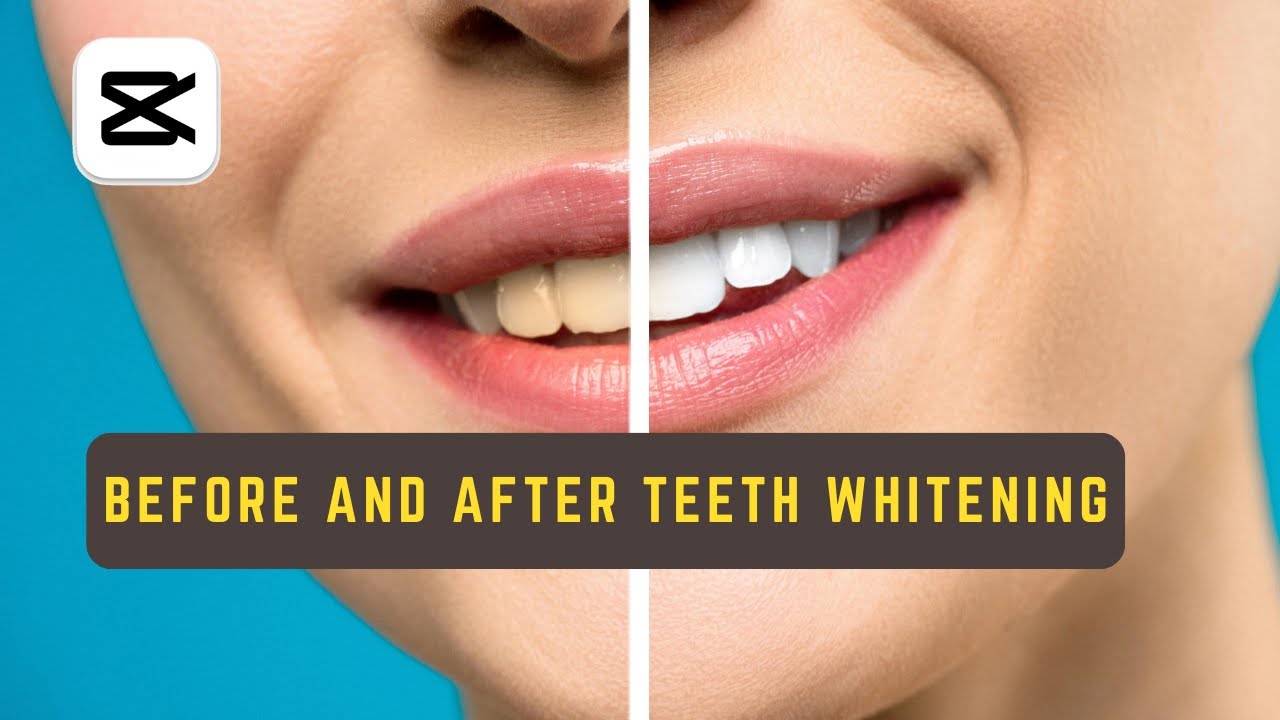 Before and After Teeth Whitening Photo Edit Tutorial on CapCut PC (2024 ...