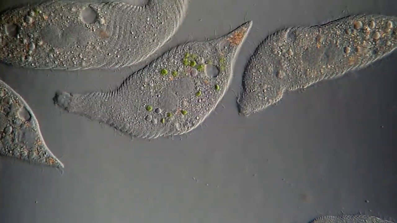 Lacrymaria (ciliate) | Under Microscope - YouTube