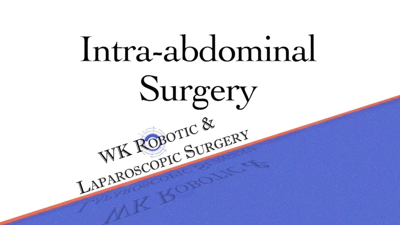 Intra-abdominal Surgery - Willis Knighton Health - YouTube