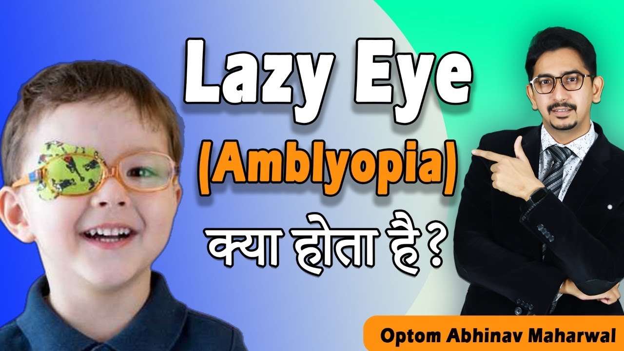 What is Amblyopia (Lazy Eye)? || Lazy Eye Treatment || What is ...