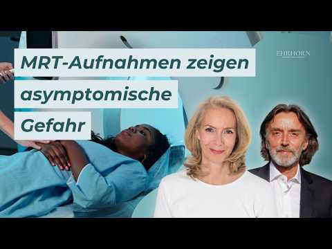 Hirnveränderung bei jungen Menschen mit Spike-Belastung beobachtet
