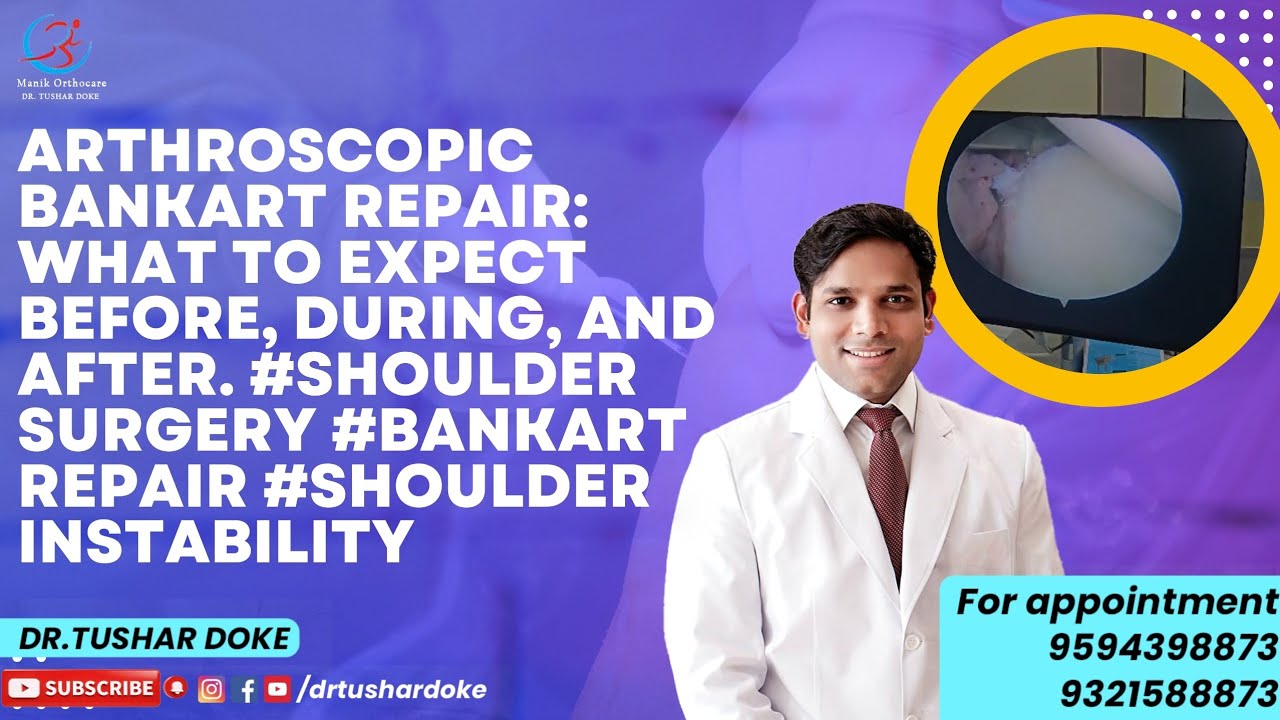 Arthroscopic Bankart Repair: What to Expect Before, During, and After ...