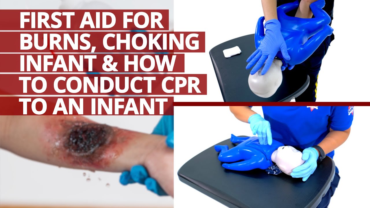 First Aid for Burns, Infant Choking & How to Conduct CPR to an Infant ...