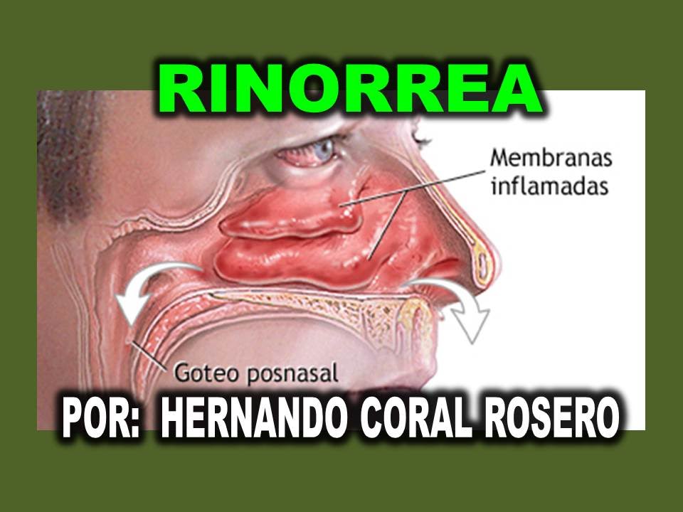 RINORREA - SECRECIÓN NASAL - YouTube