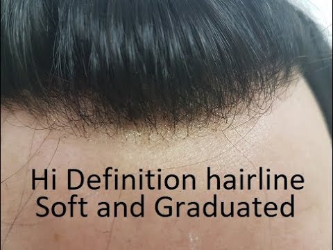 Hair Replacement System Fitting with new improved hairline design - YouTube