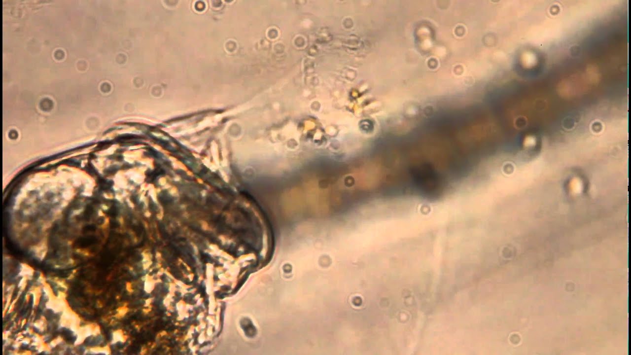 Rotifer trophi and mastax - YouTube