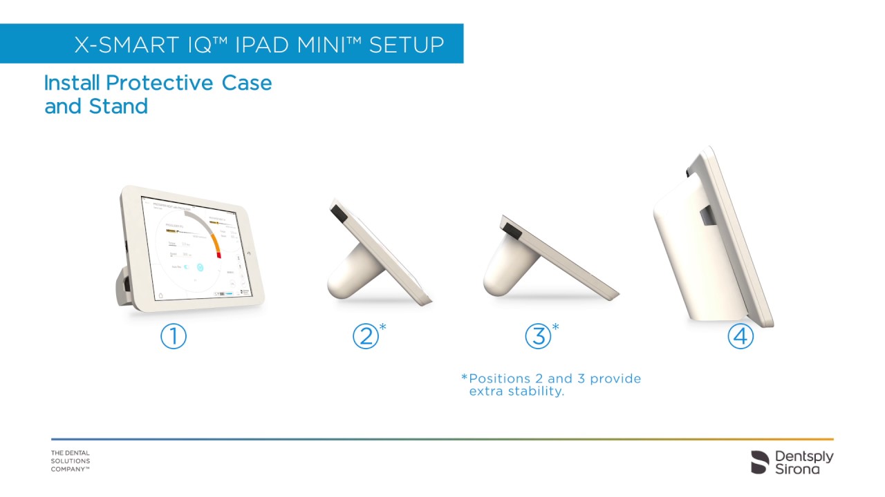 The X-Smart IQ Set Up - YouTube