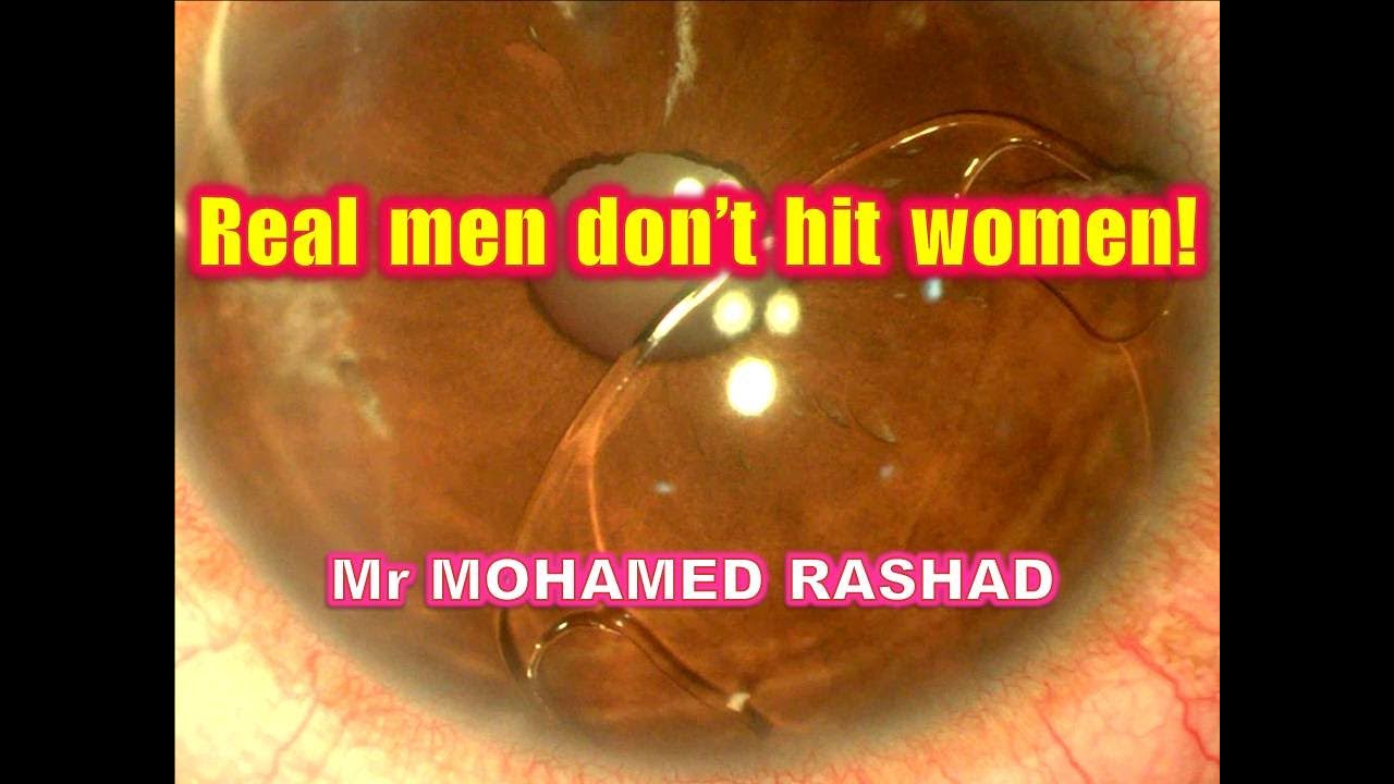 Secrets of Reposition of dislocated Artisan iris claw phakic ...