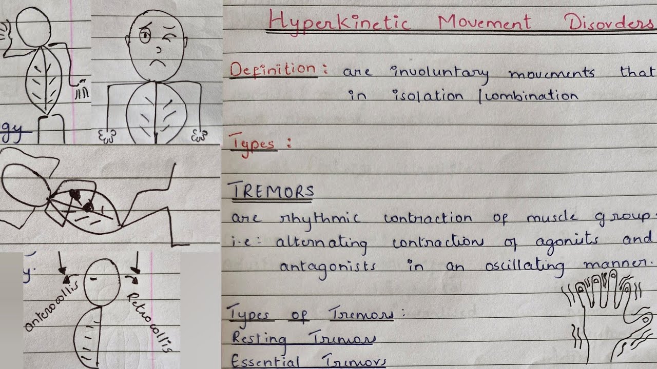 Which Are The Hyperkinetic Movement Disorders ?Tremors/Dystonia/Chorea ...