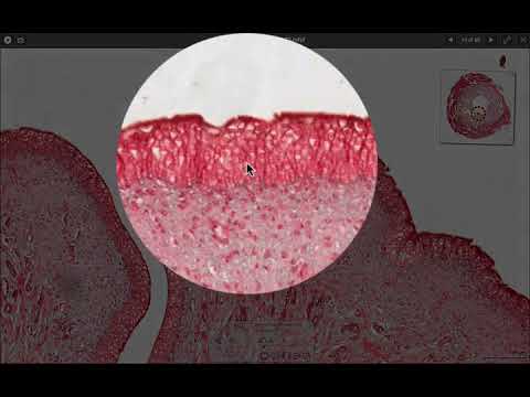 What your bladder and ureter look like down the microscope - YouTube