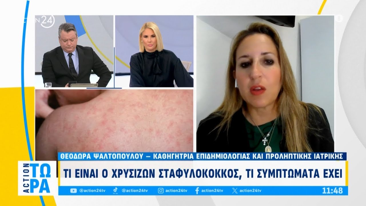 Χρυσίζων σταφυλόκοκκος: Τι είναι και ποια συμπτώματα έχει | ACTION Τώρα ...