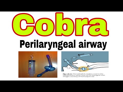 Cobra perilaryngeal airway |it's uses |advantages |disadvantages |@anaesthesiawithbabar2576