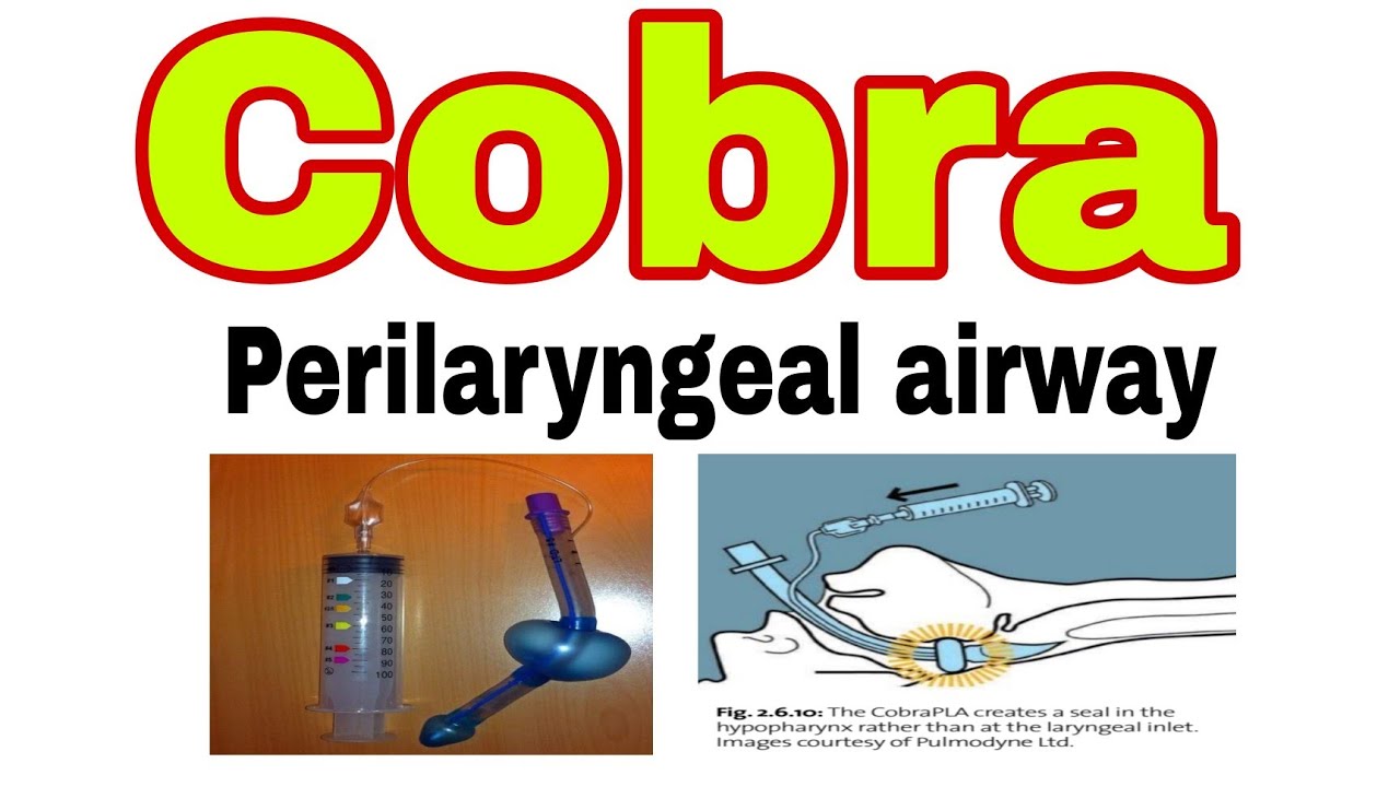 Cobra perilaryngeal airway |it's uses |advantages |disadvantages ...