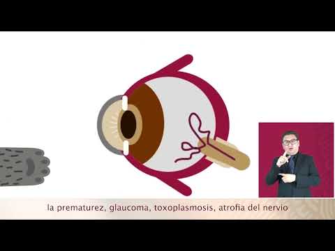 Discapacidad Visual