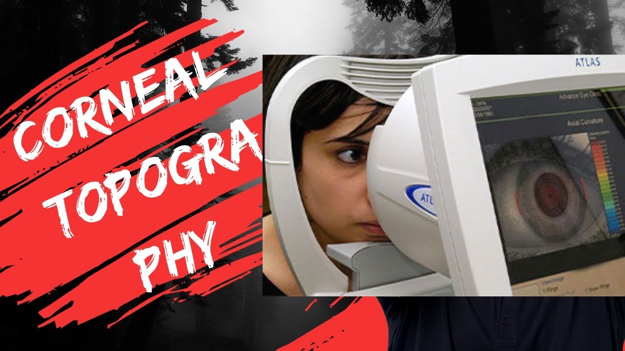 corneal topography part 02 /How to do corneal topography/details and ...