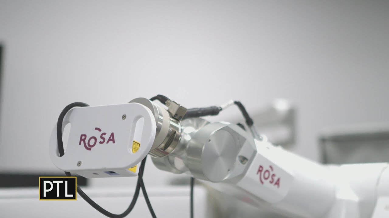 Eye On Health: ROSA robot helping patients with epilepsy - YouTube