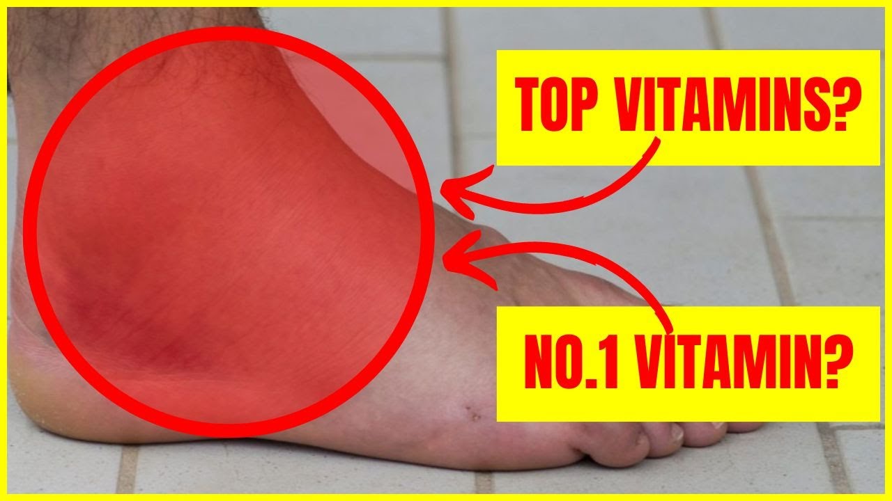 Top Vitamins to Reduce Swollen Legs and Feet | No.1 vitamin for ...