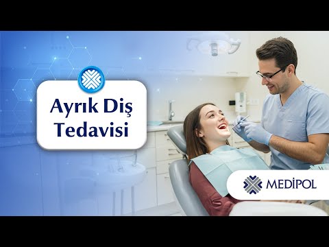Ayrık Diş Tedavisi Nasıl Yapılmaktadır?