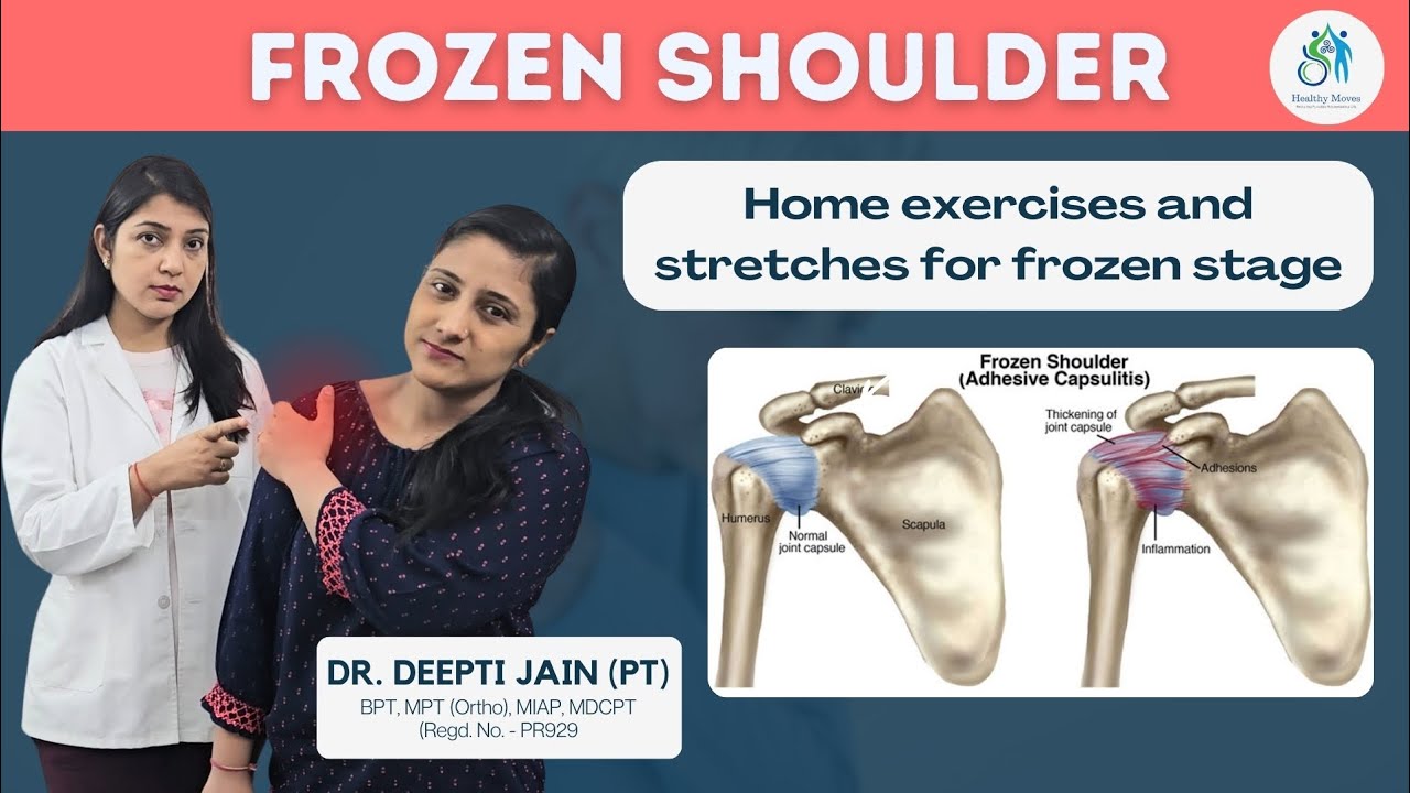 Frozen shoulder:Exercises and Stretches for frozen stage |Adhesive ...