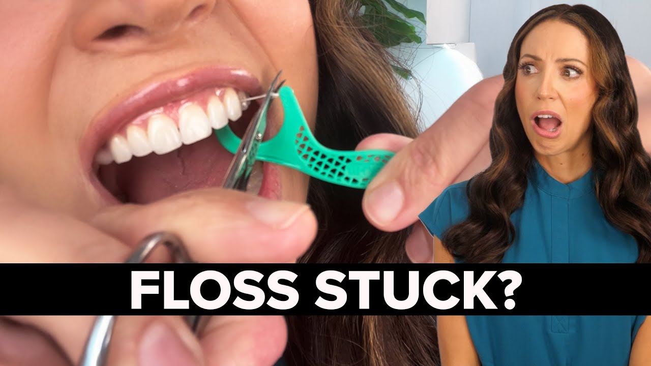 Floss Stuck Between Teeth? Here’s What to Do! - YouTube