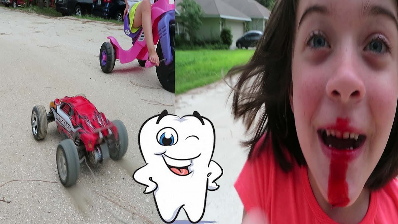 ** CRAZY TOOTH PULLED GONE WRONG!!**( DAY #300 ) - YouTube