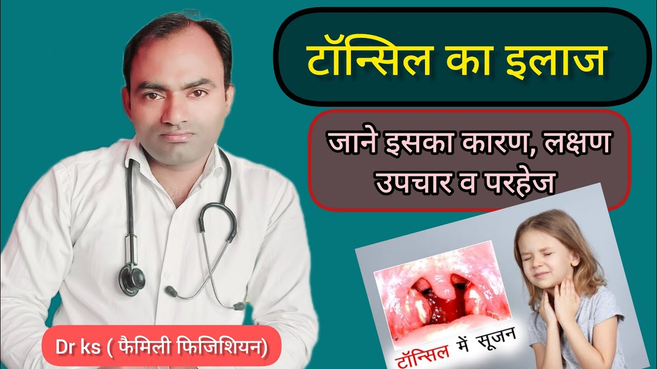 Tonsil ka ilaj l tonsil hone par kya kare l tonsil ki tablet l - YouTube