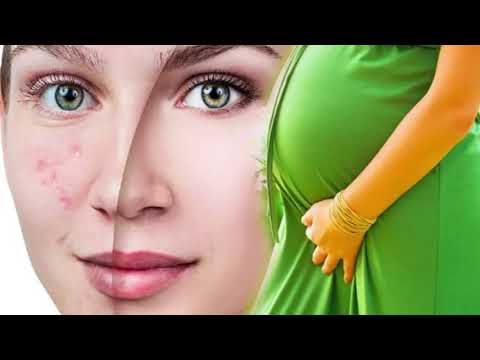 Gebelikteki Lekeler Nasıl Geçer ? Doğal Yollarla Kurtlun  Nedenlerini ve Belirtilerini Öğrenin