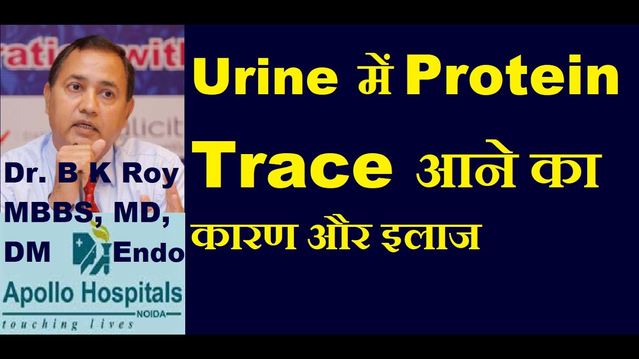 Urine Protein urine-protein