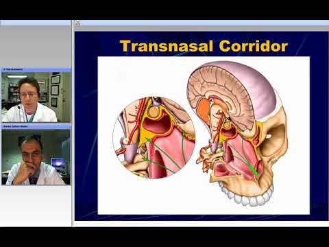 Grand Rounds Endoscopic Skull Base Surgery Transclival, Transmaxillary ...