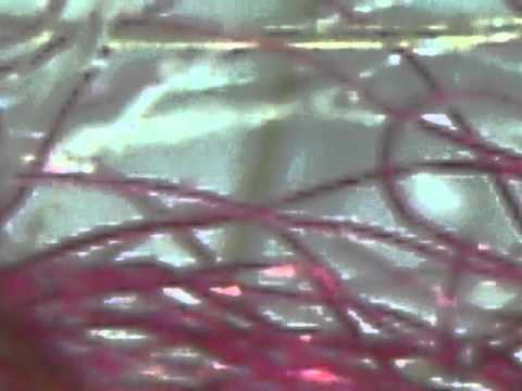 Morgellons hair under microscope with multicolor fibers Part 1 - YouTube