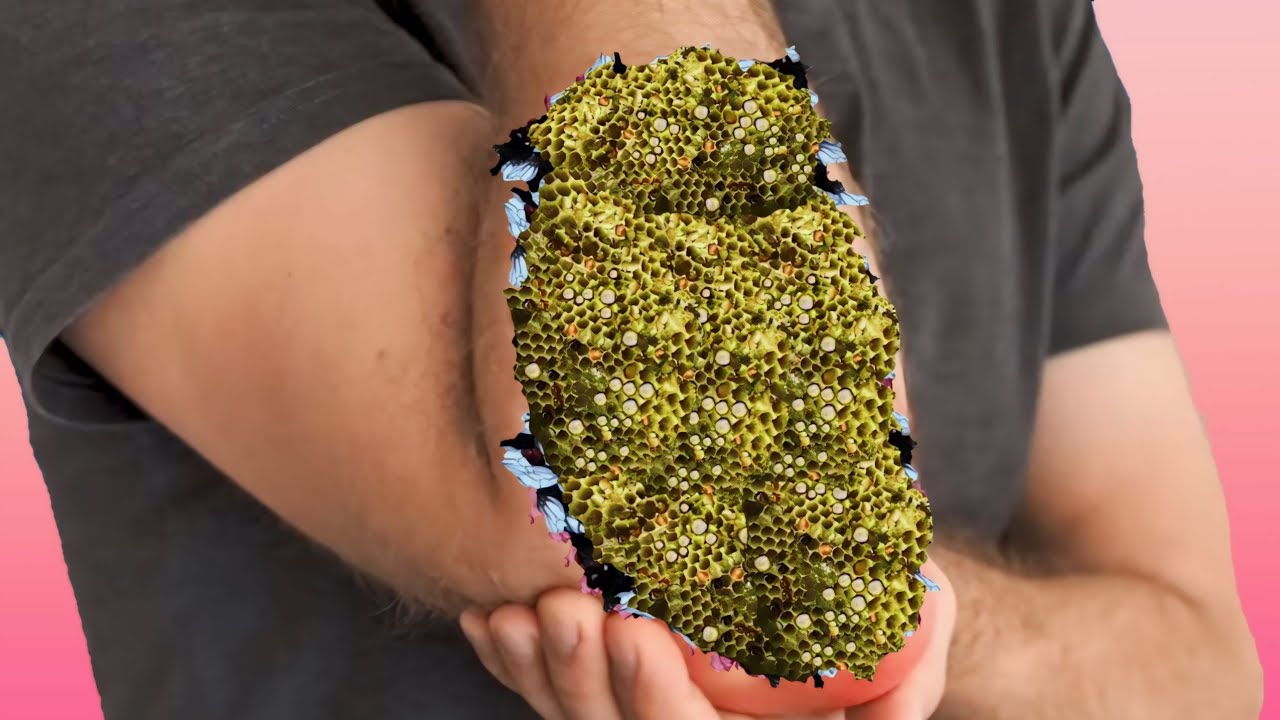 Asmr deep doctor severely affected by / maggot hand treatment cleaning ...