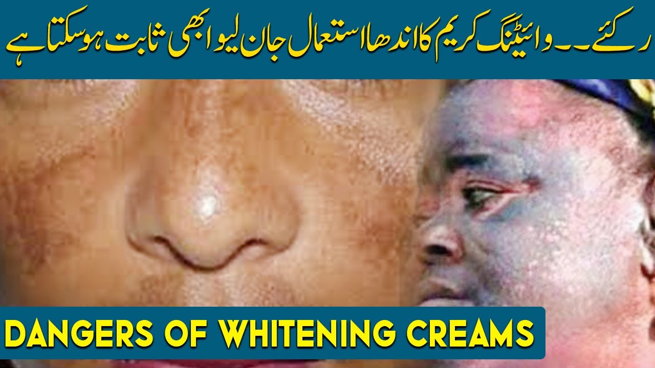 Hidden dangers of skin whitening creams: Unveiling the truth ...
