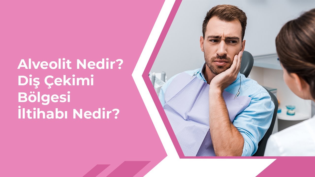 Alveolit Nedir? Diş Çekimi Bölgesi İltihabı Nedir? - YouTube