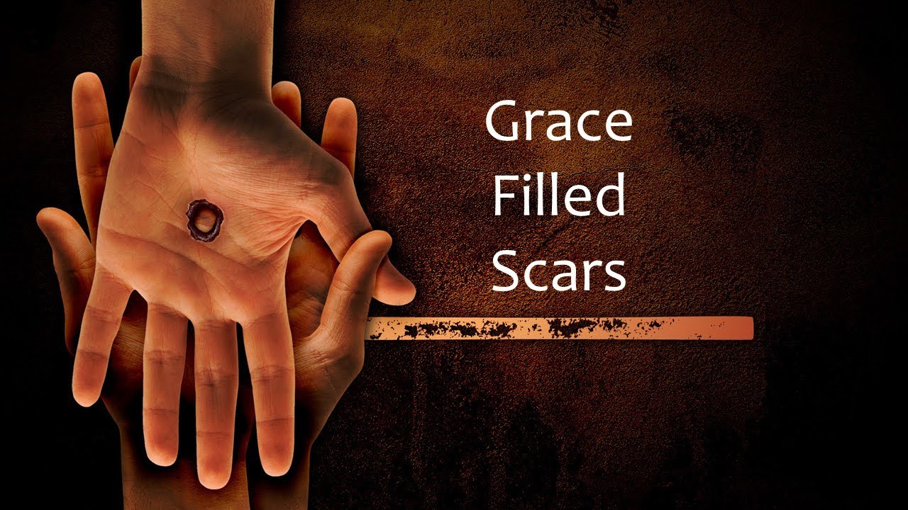 "Tired" part 4- Grace-Filled Scars (sermon only) - YouTube