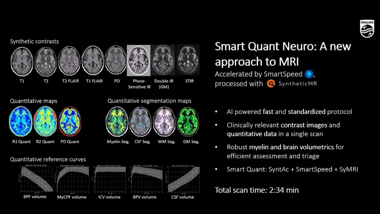 New Standards in Neuro Imaging with Fast AI-based Quantification - YouTube