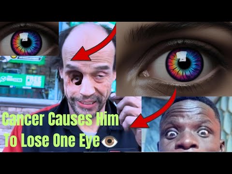 #Cancer_of_Eye cancer is very bad , may God eus 😳 - YouTube