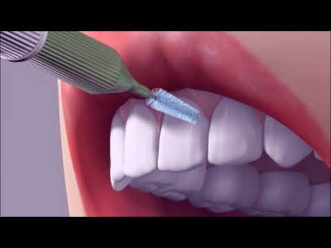 Igienizarea interdentara - Periutele interdentare - YouTube