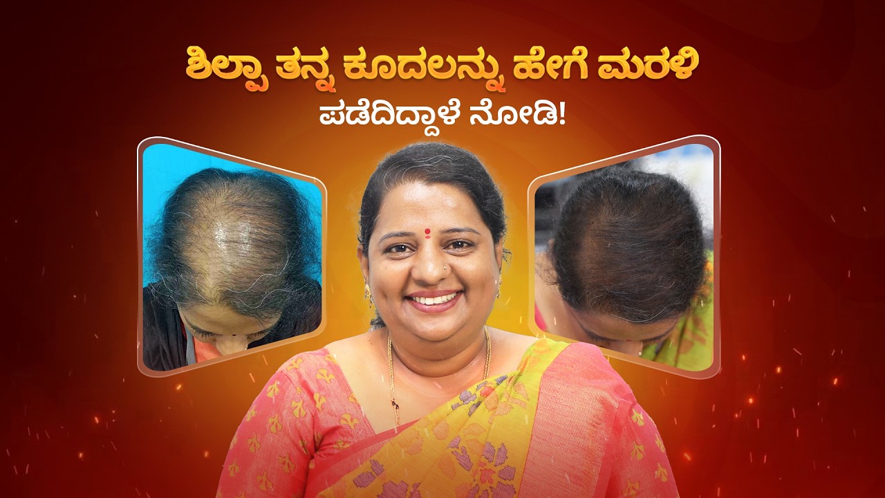 The Answer to My 15-Year Hair Loss Struggle? VCare! BioCell 360: Real ...