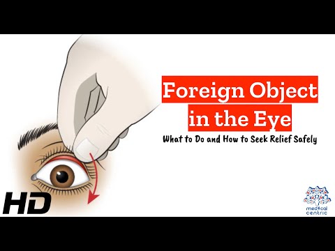 What To Do If Something Flies Into Your Eye