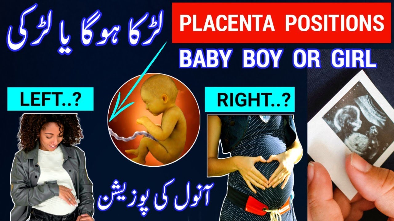 Placenta Positions and Baby Gender |Baby Boy or Girl |Beta Hoga Ya Beti ...