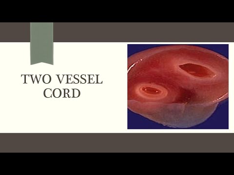 TWO VESSEL CORD - YouTube
