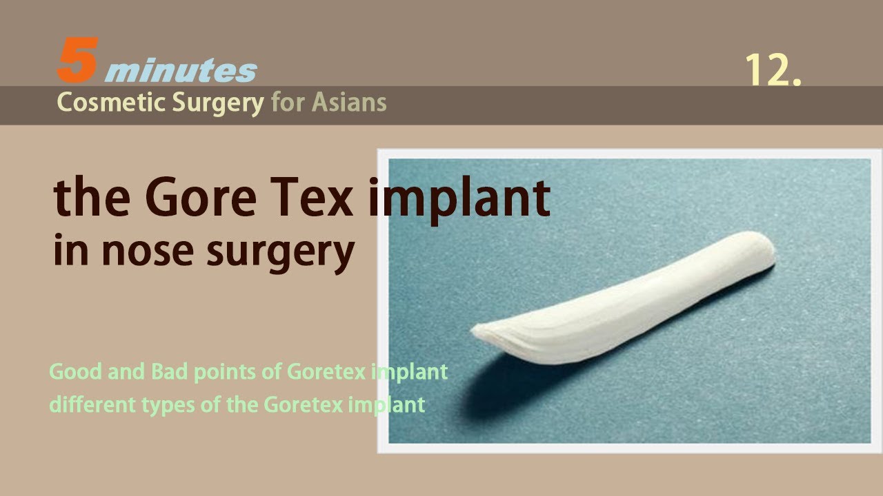 the gore-tex implant in nose surgery - YouTube